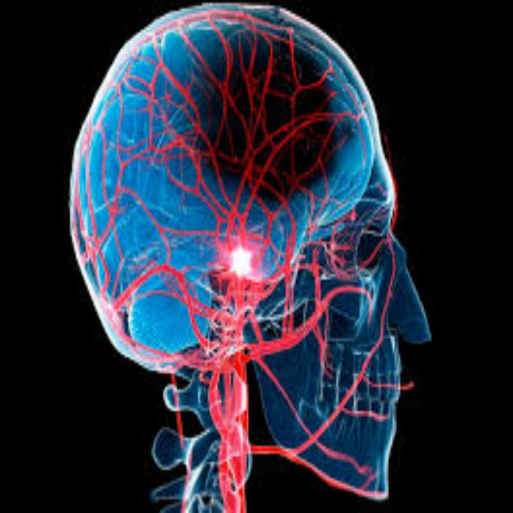 On the Couch: Stroke Prevention | Newstalk