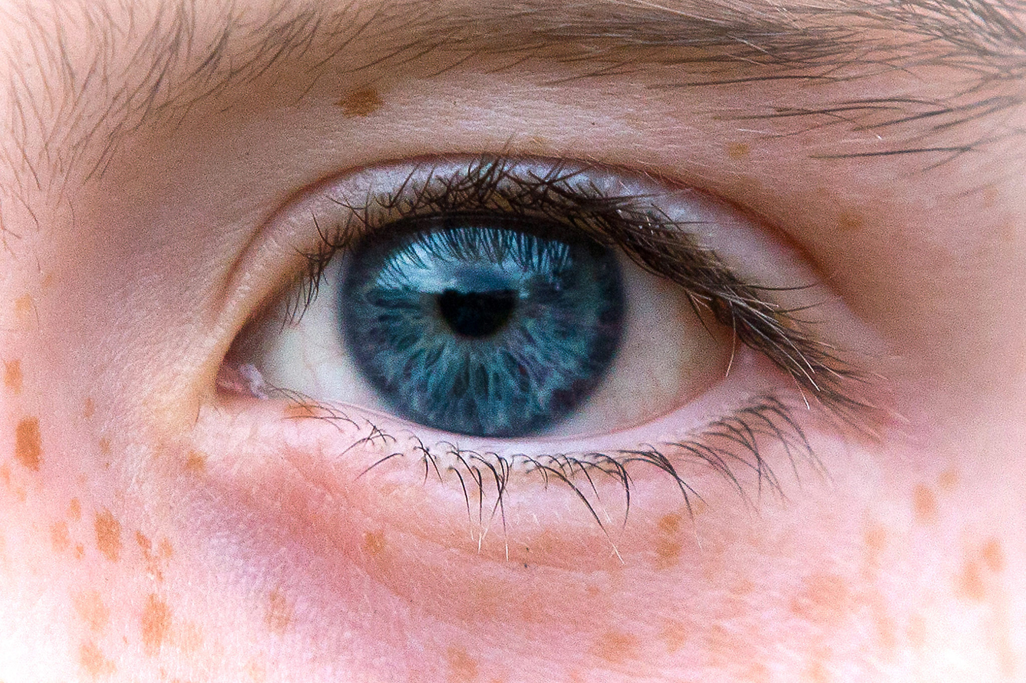 Adapting to life after 90% sight loss in just 12 months | Newstalk