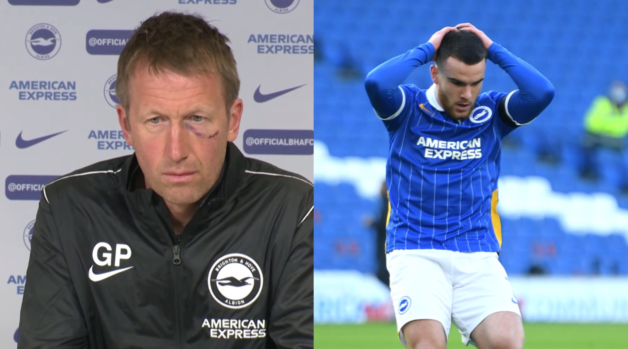 Brighton boss Potter addresses Connolly's "frustrating" season
