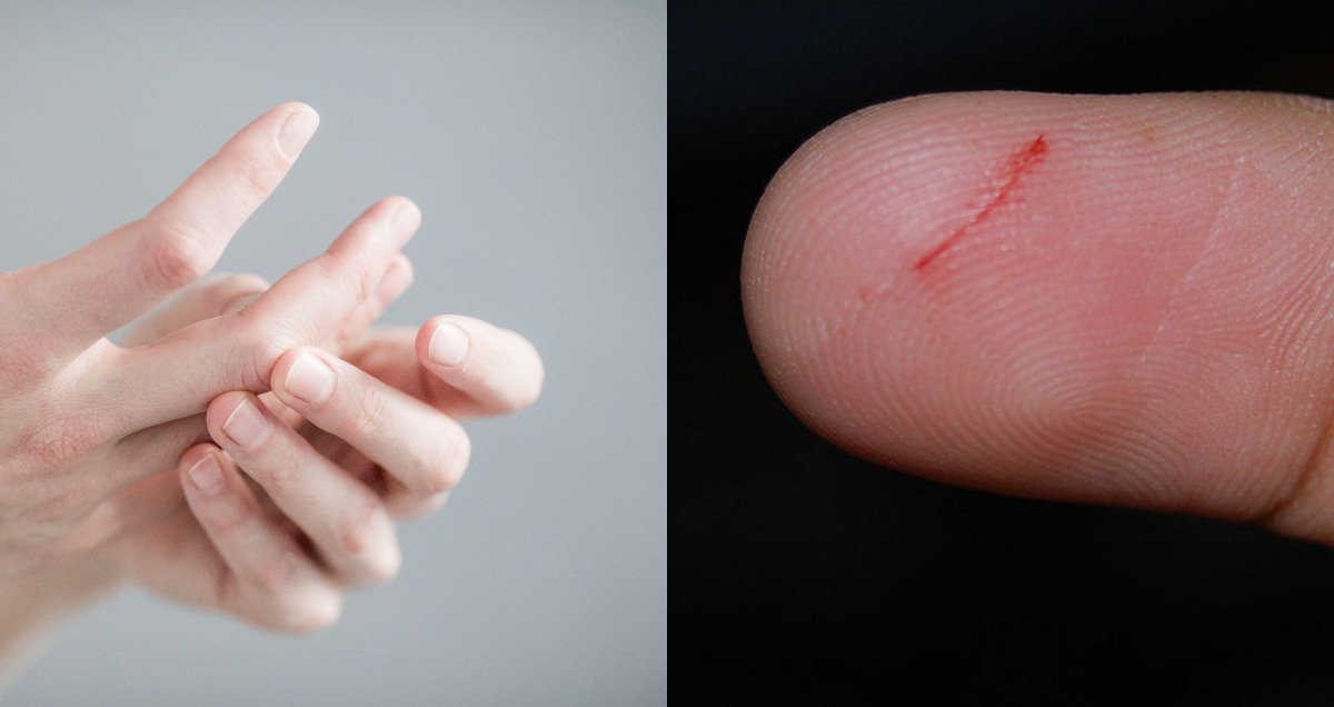 Why Do Papercuts Hurt So Badly why-do-papercuts-hurt-so-badly