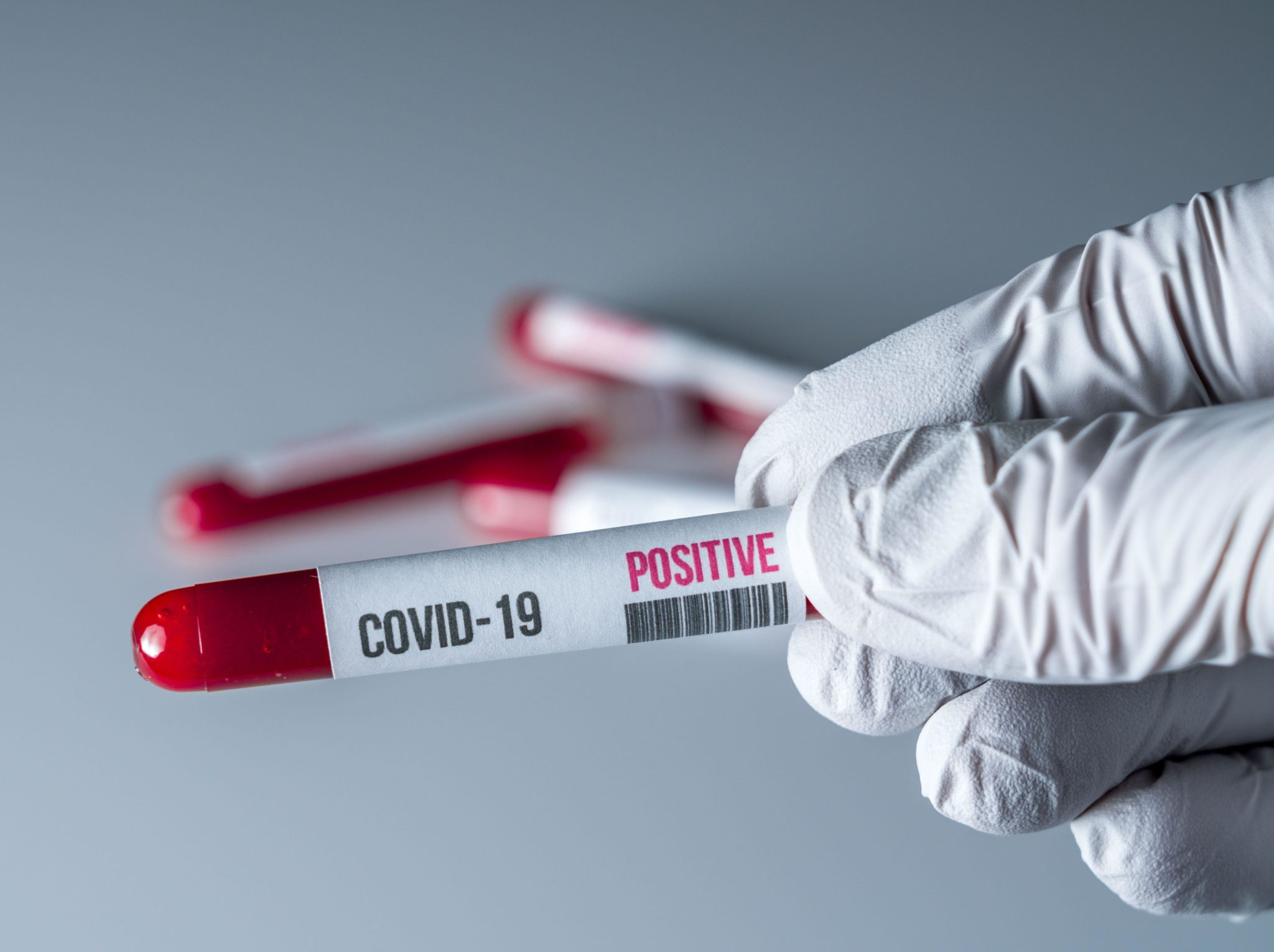 COVID-19: 5,265 Further Cases, 4,673 Positive Antigen Tests | www.98fm.com