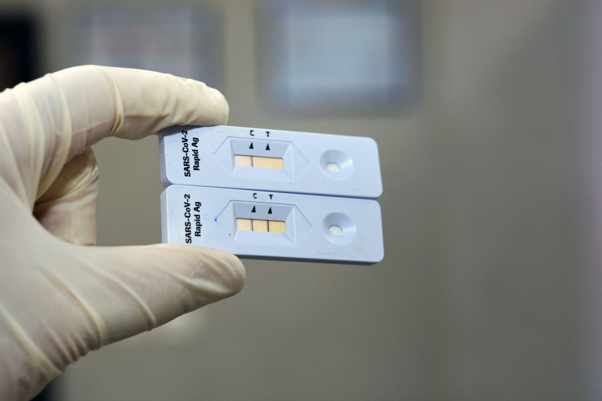 COVID-19: 5,649 PCR-confirmed cases, 5,387 positive antigen tests ...