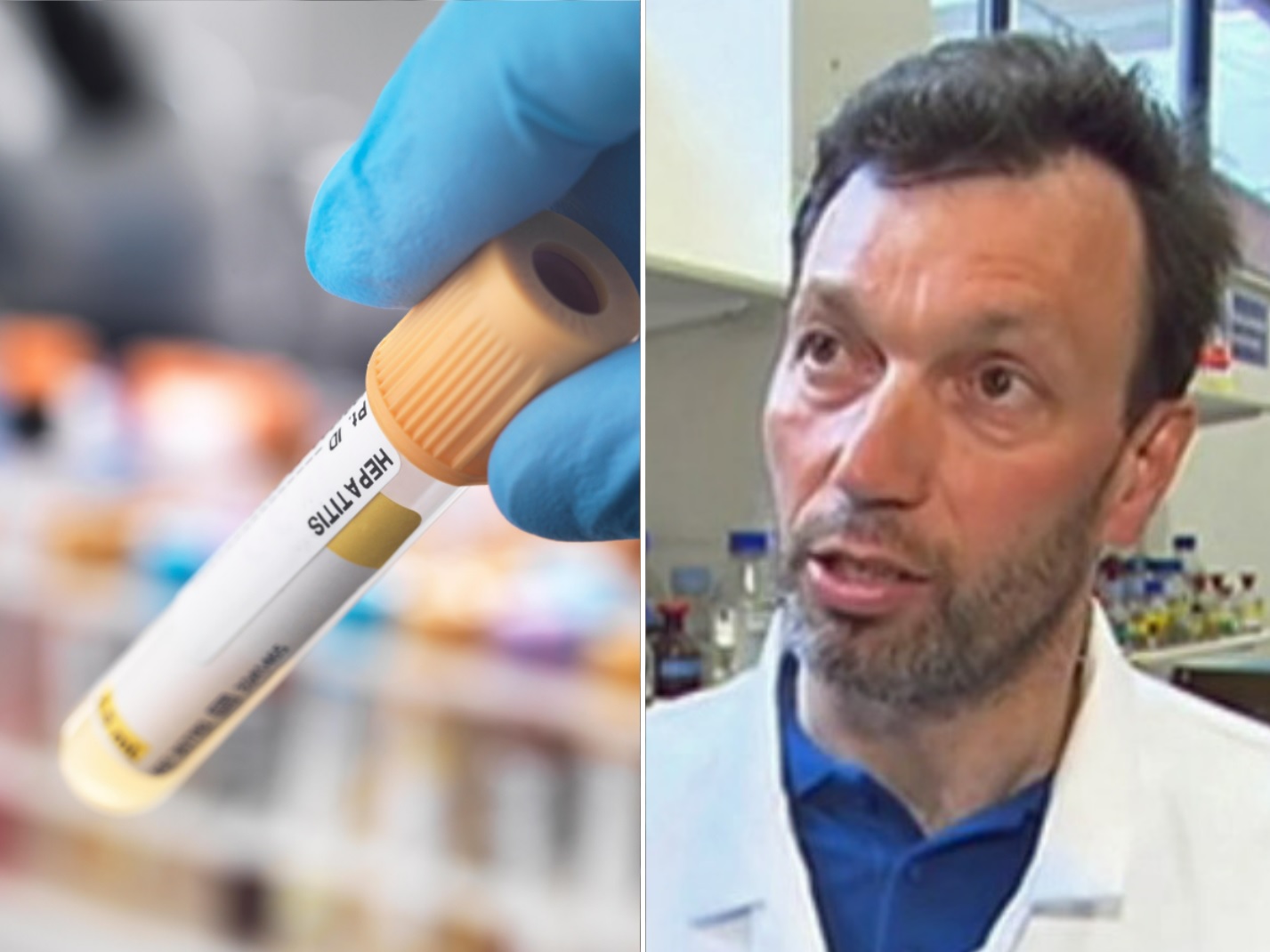 Sam McConkey: Social distancing may have contributed to hepatitis ...