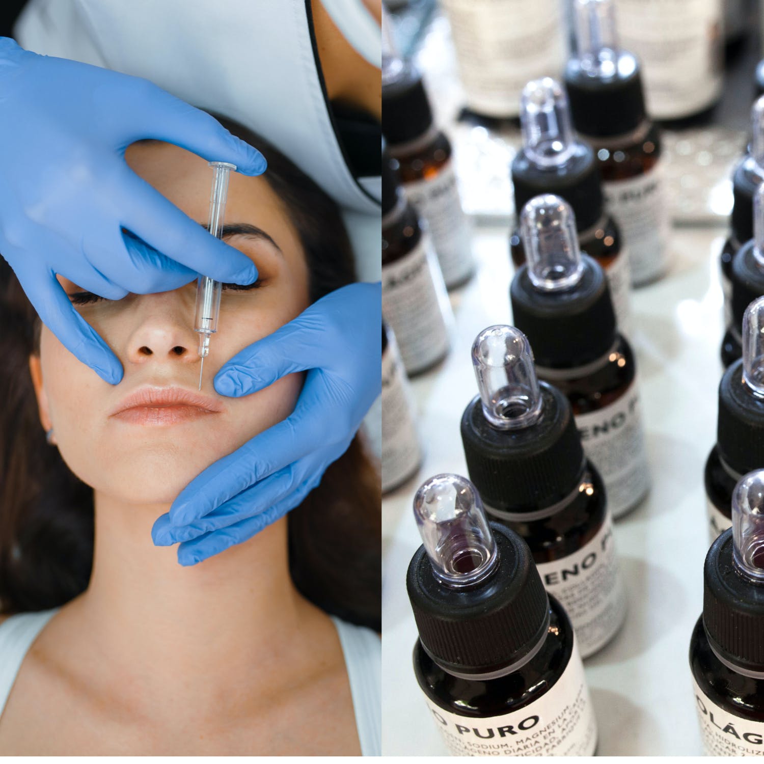 Everything You Need To Know About Cosmetic Injections