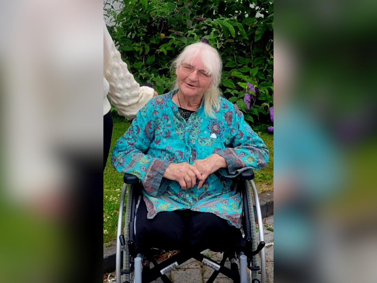 Woman has both legs amputated after insect bites: 'It's a major change ...